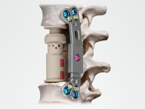 XPand™ Product Page - Expandable Technology