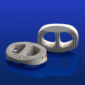 SUSTAIN® Large ALIF Spacer | Globus Medical
