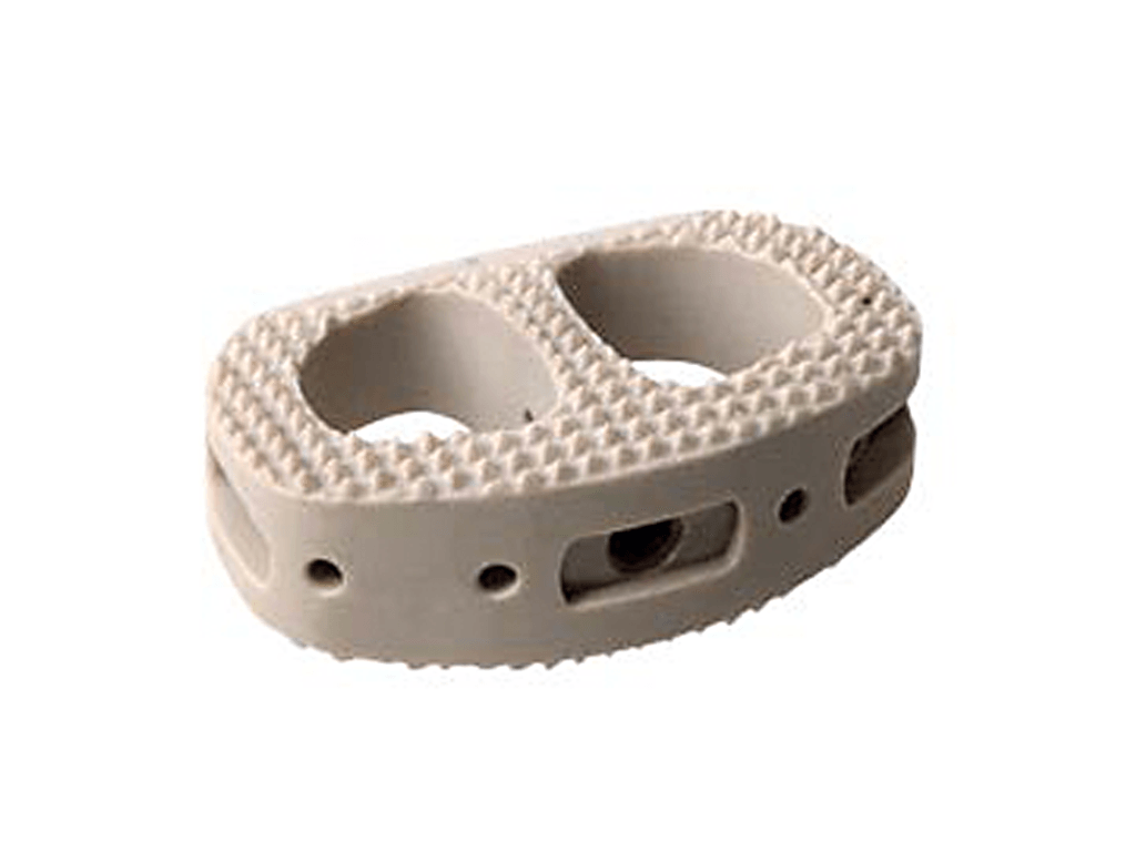 Anterior Lumbar | International