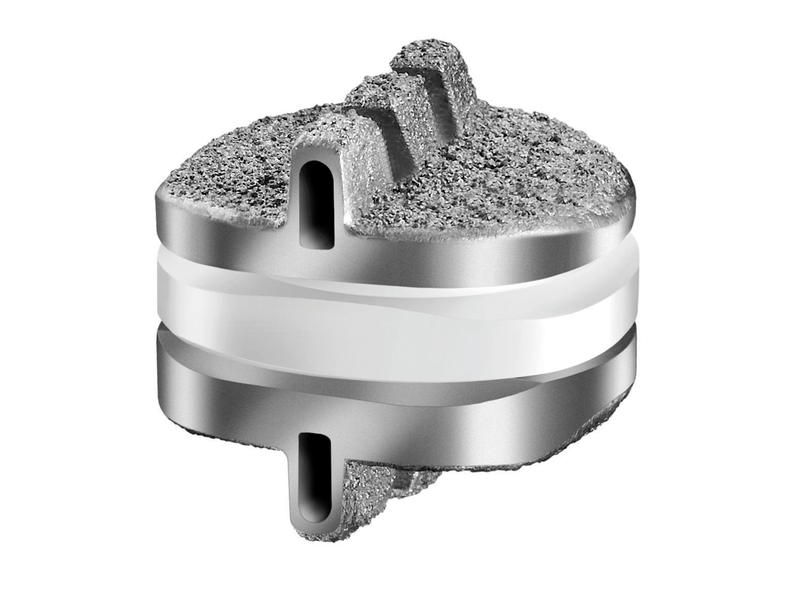 SECURE-C™ Cervical Artificial Disc | Globus Medical