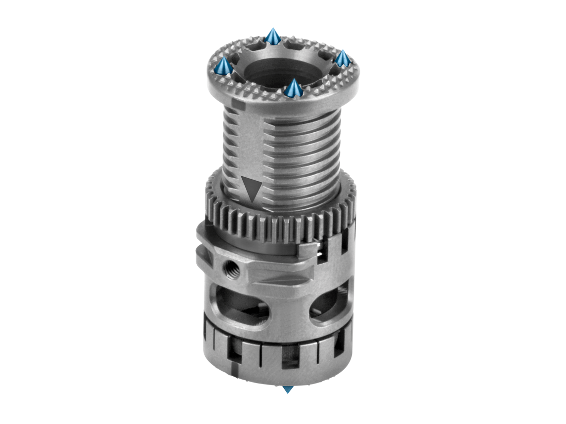 Vertebral Body Replacement | International