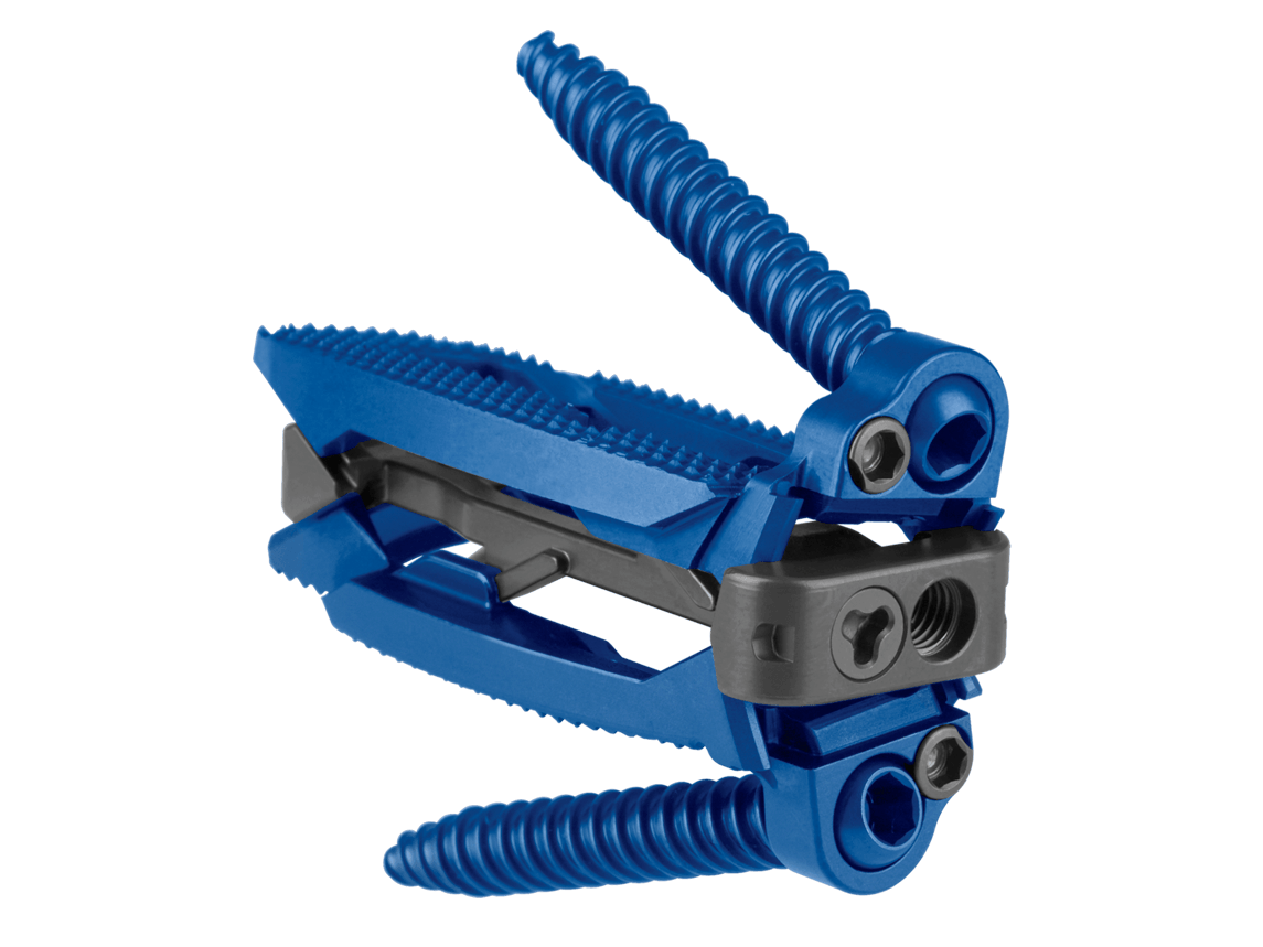 ELSA™ Expandable Integrated Lateral Interbody Spacer | Globus Medical