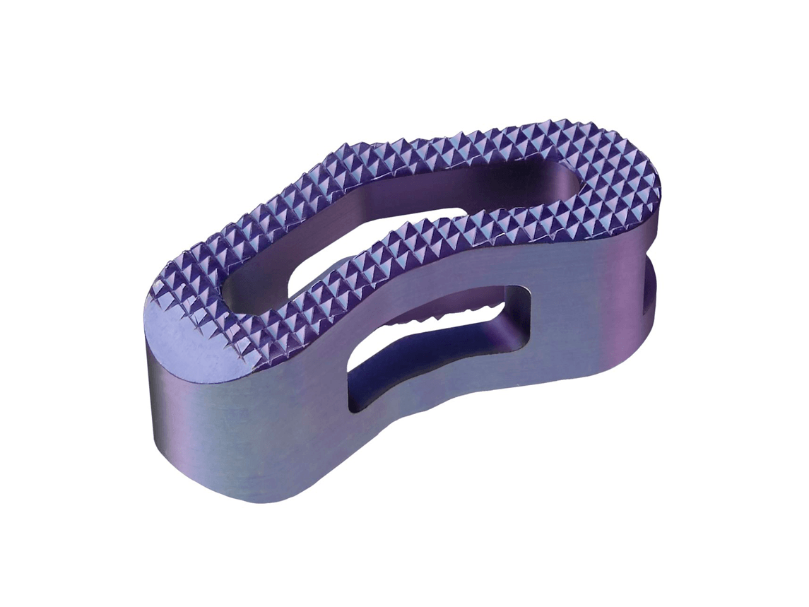 SUSTAIN™ Arch Thoracolumbar Intervertebral Spacer | Globus Medical