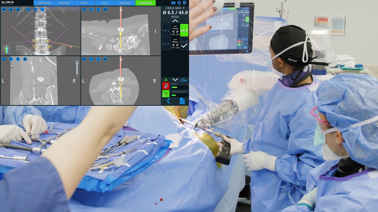 ExcelsiusGPS® ロボットナビゲーション | グローバスメディカル