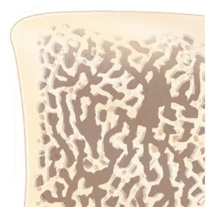 Minimally Invasive Vertebral Augmentation Procedure | Globus Medical