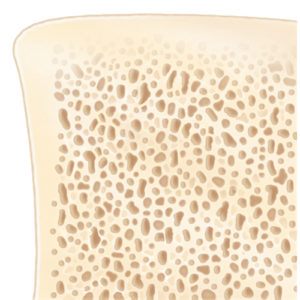 Minimally Invasive Vertebral Augmentation Procedure | Globus Medical