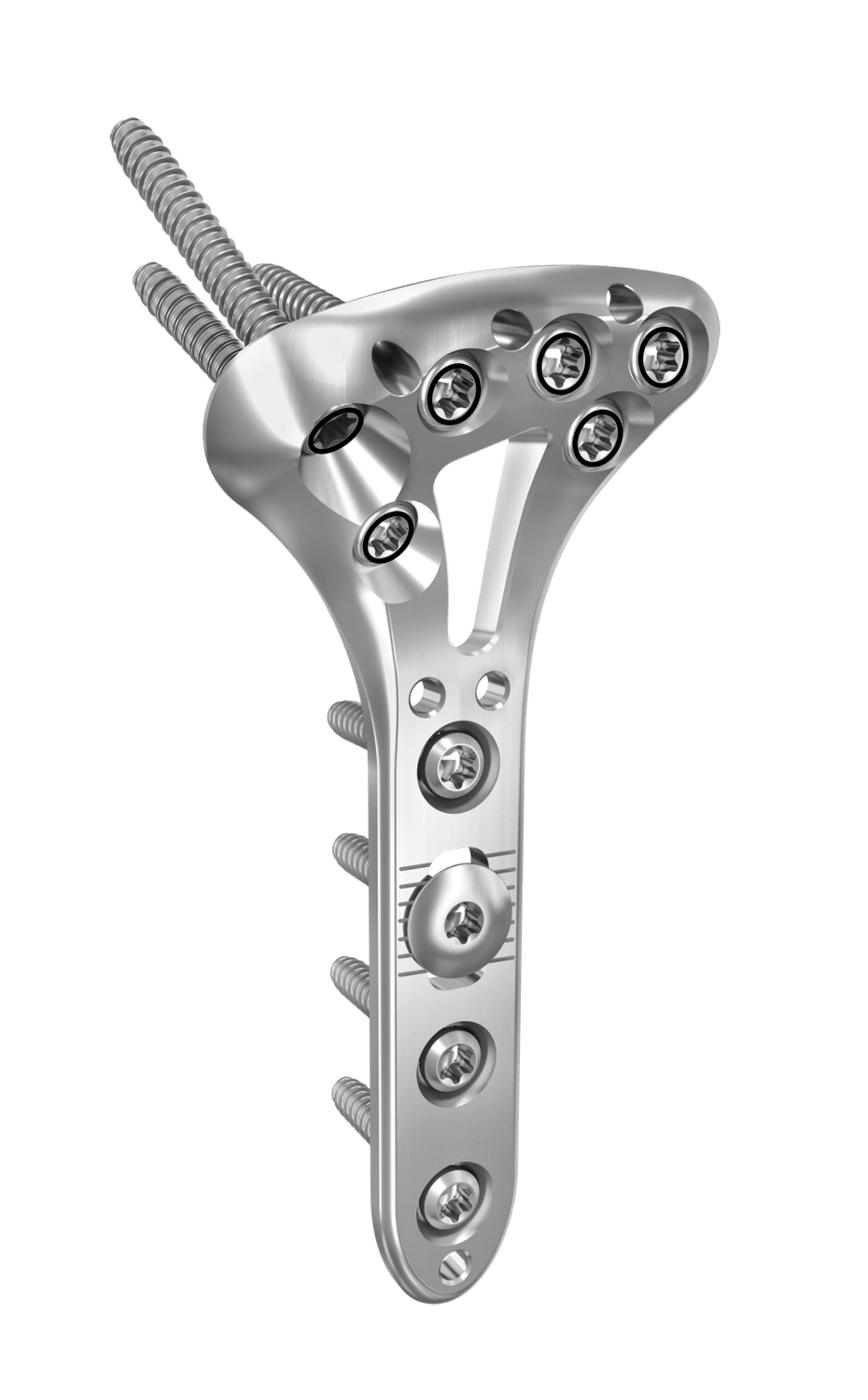 Distal Radius Volar Plate