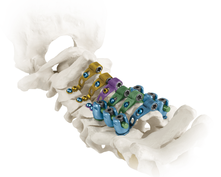 Posterior Cervical Fusion Procedure | Globus Medical