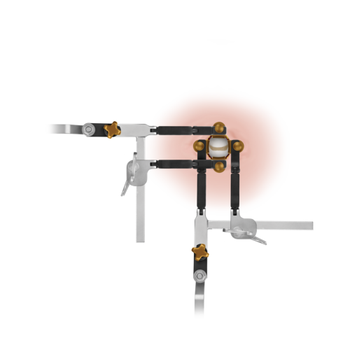 COALITION AGX™ Anterior Cervical Plating System | Globus Medical