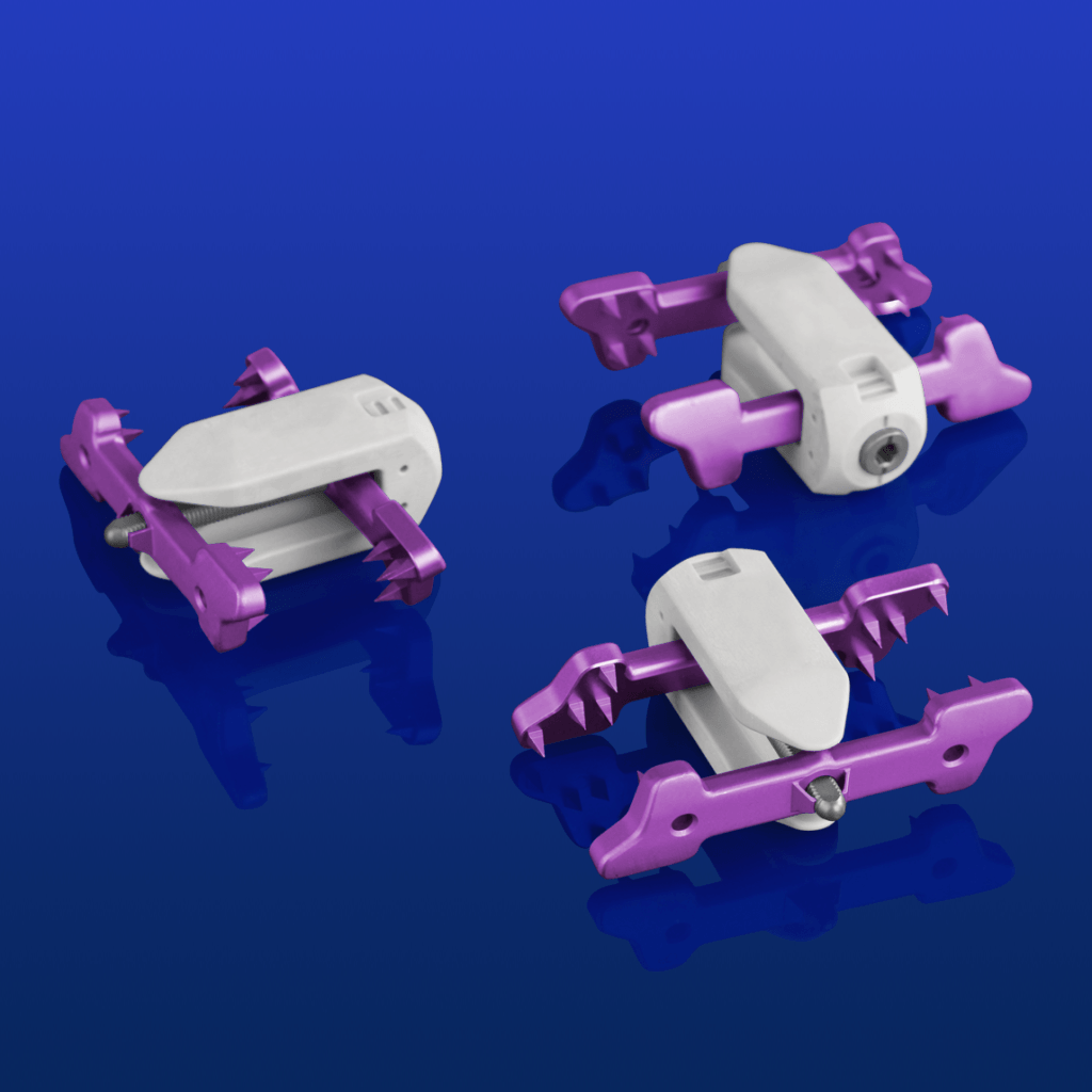 SP-FIX™ Spinous Process Fixation Device | Globus Medical