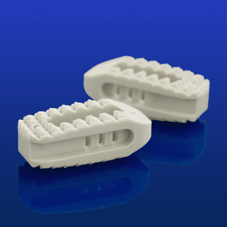 SUSTAIN® Small Thoracolumbar Intervertebral Spacer | Globus Medical