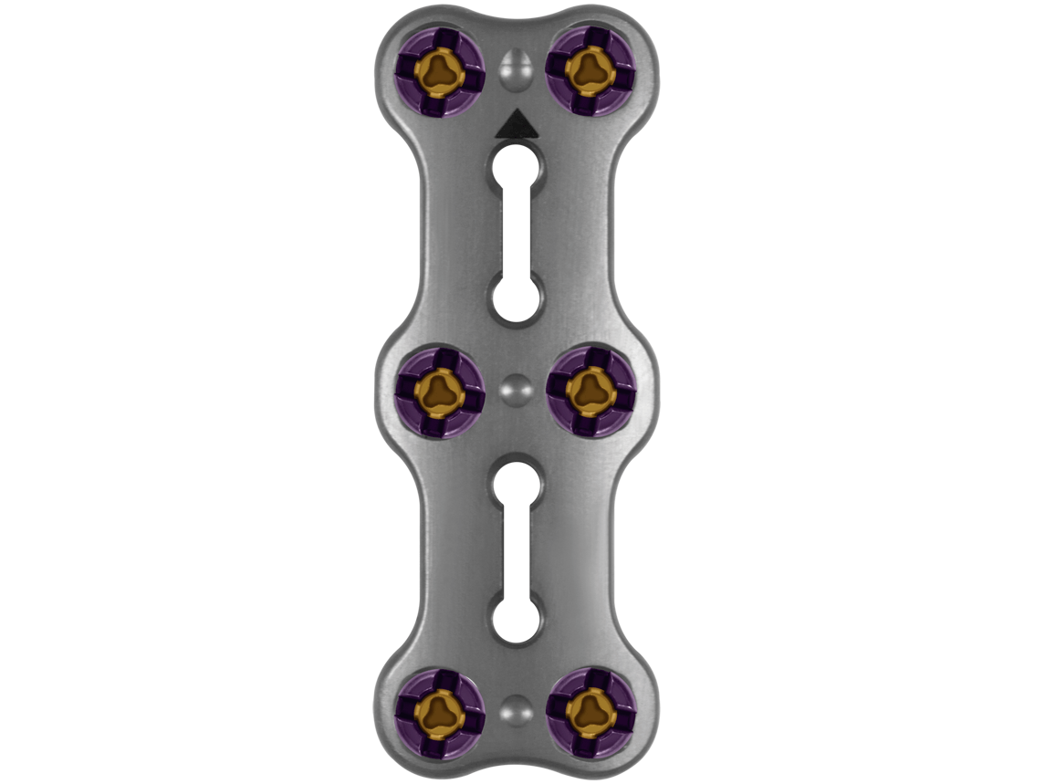 ASSURE™-X Anterior Cervical Plates | Globus Medical