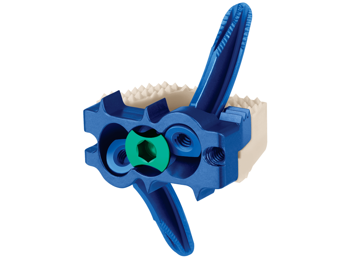 COALITION MIS™ ACDF Spacer | Globus Medical