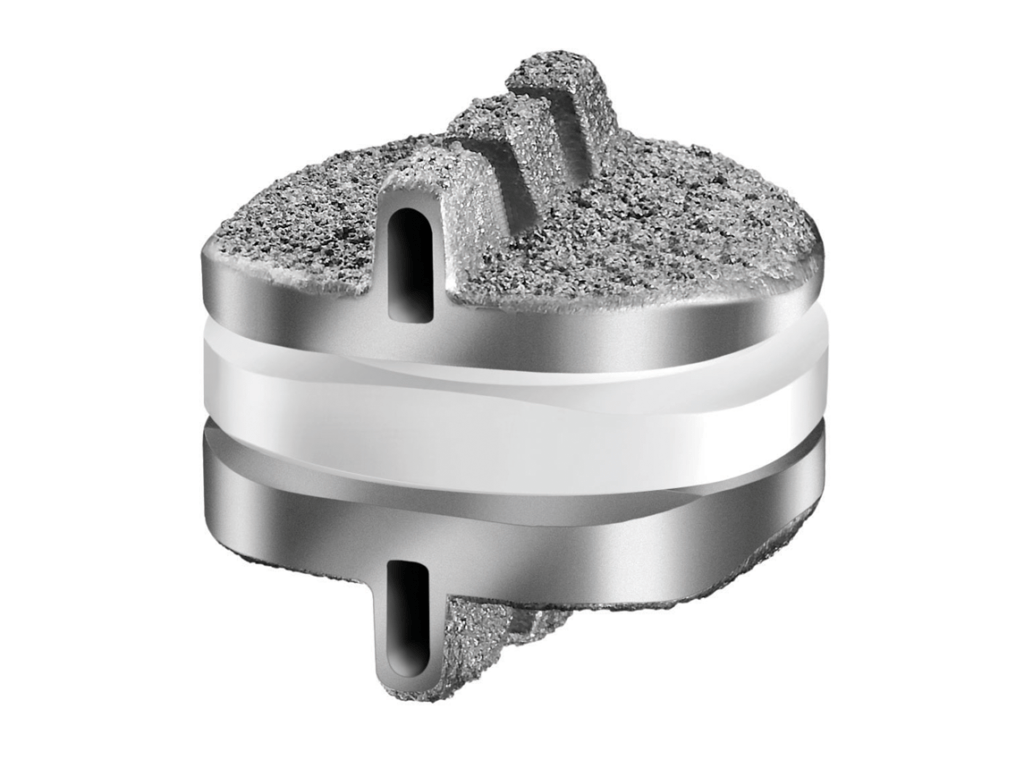 Interbody Spacers Archives | Globus Medical