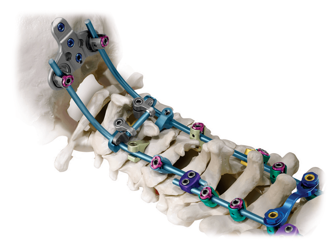ELLIPSE™ Posterior Occipito-Cervico-Thoracic Stabilization System ...