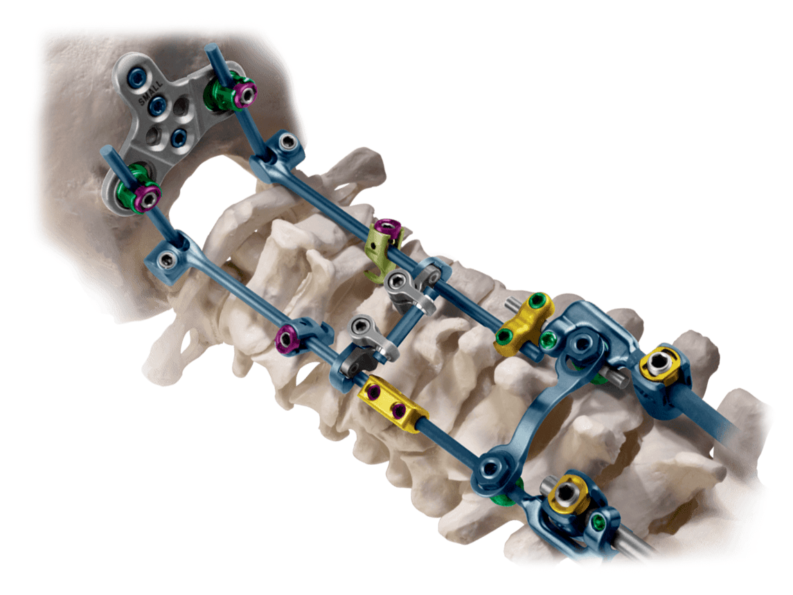 ELLIPSE™ ADDITION-C Posterior Occipito-Thoracic Stabilization Revision ...