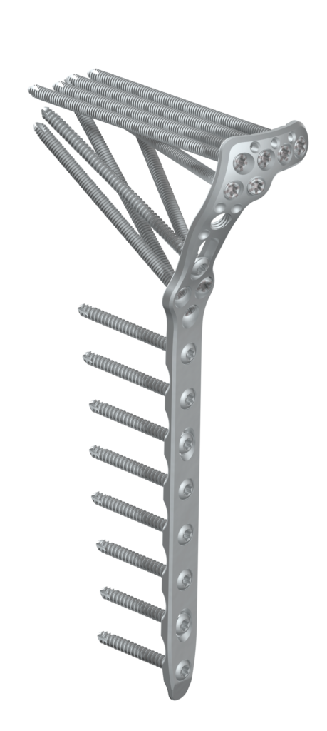 ANTHEM® Proximal Tibia Fracture System | Globus Medical
