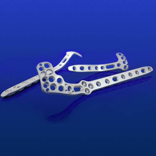 AUTOBAHN® EVO Retrograde Femoral Nailing System | Globus Medical