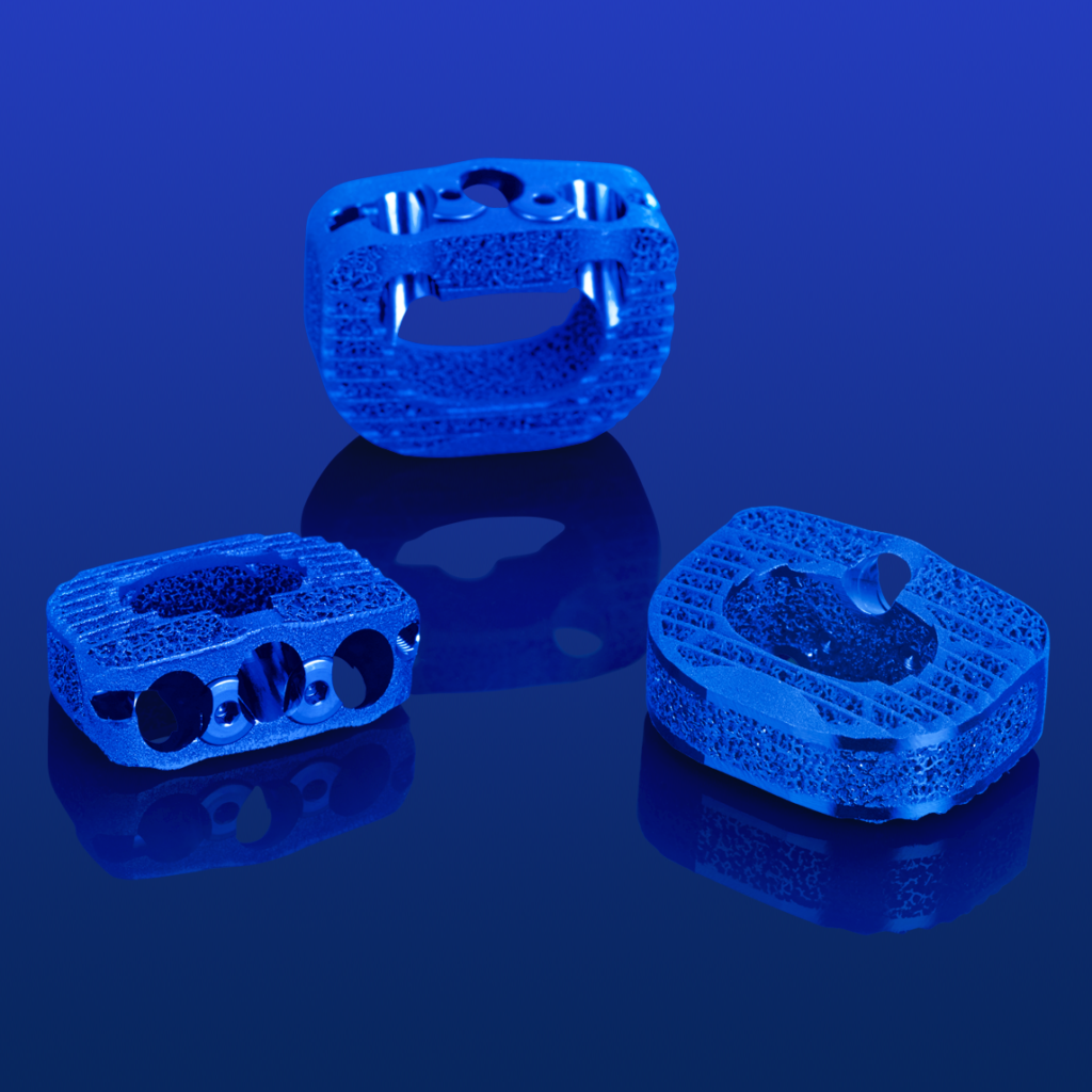 HEDRON IA® 3D Printed ALIF Spacer | Globus Medical