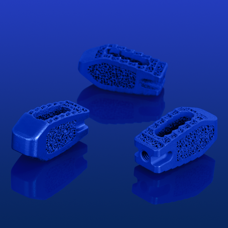 HEDRON P® 3D Printed PLIF spacer | Globus Medical