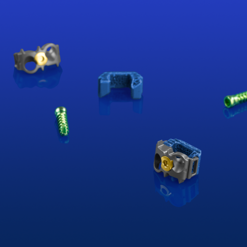 HEDRON C® 3D Printed Spacer | Globus Medical