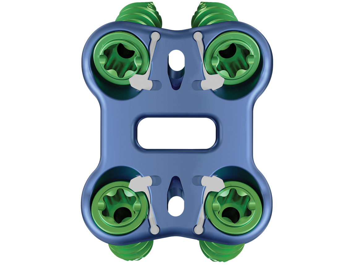 RESONATE™ Anterior Cervical Plate System | Globus Medical