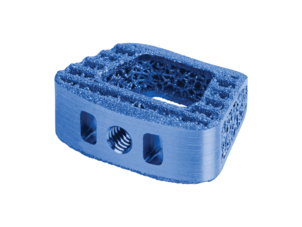 Anterior Cervical | Globus Medical