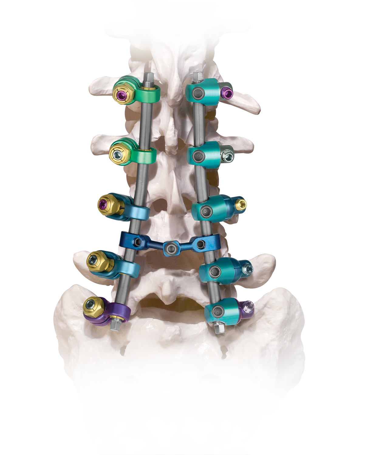 BEACON® Stabilization System | Globus Medical