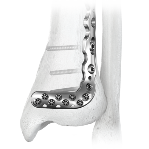 Spinal Products for Musculoskeletal Solutions | Globus Medical