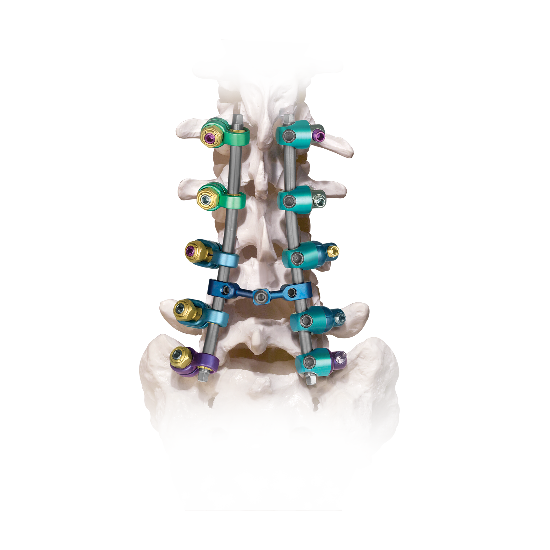 BEACON™ Stabilization System | Globus Medical