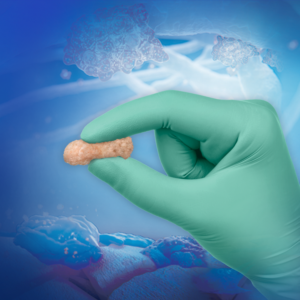 ViaCell® Viable Cell Allograft | Globus Medical