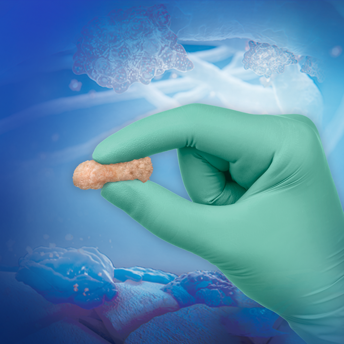 ViaCell® Viable Cell Allograft | Globus Medical