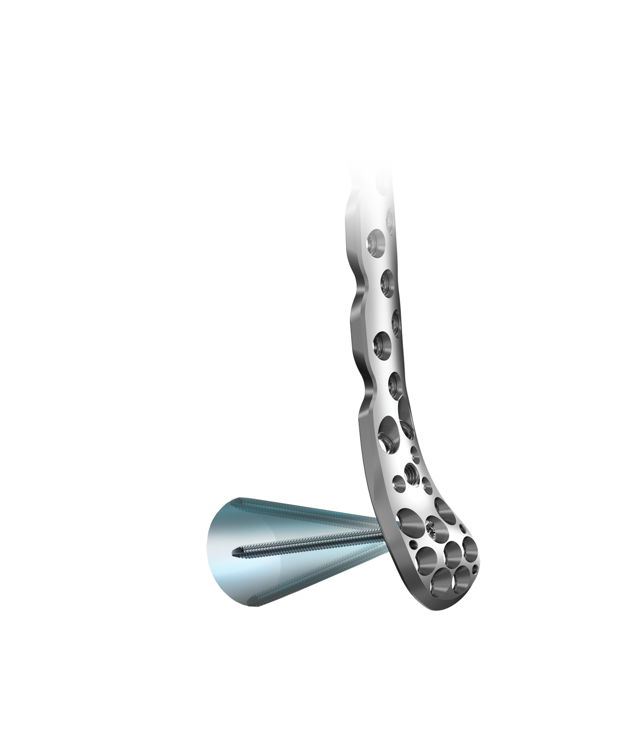 ANTHEM® Distal Femur Fracture System | Globus Medical