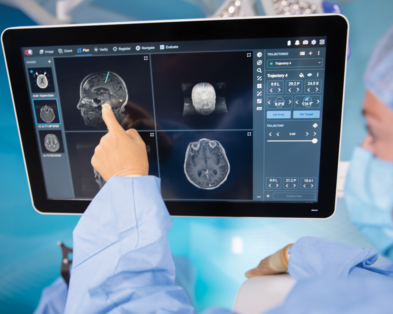 Top 5 Ways Excelsius™ Cranial Solutions Will Revolutionize Your OR ...