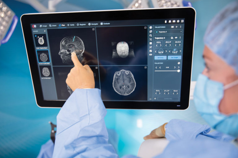 Top 5 Ways Excelsius™ Cranial Solutions Will Revolutionize Your OR ...