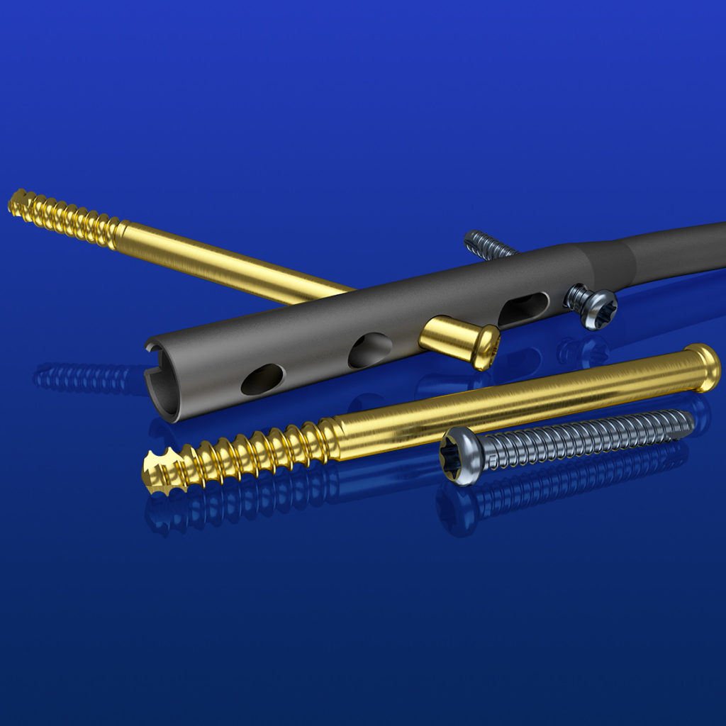 AUTOBAHN™ EVO Antegrade Femoral Nailing System | Globus Medical