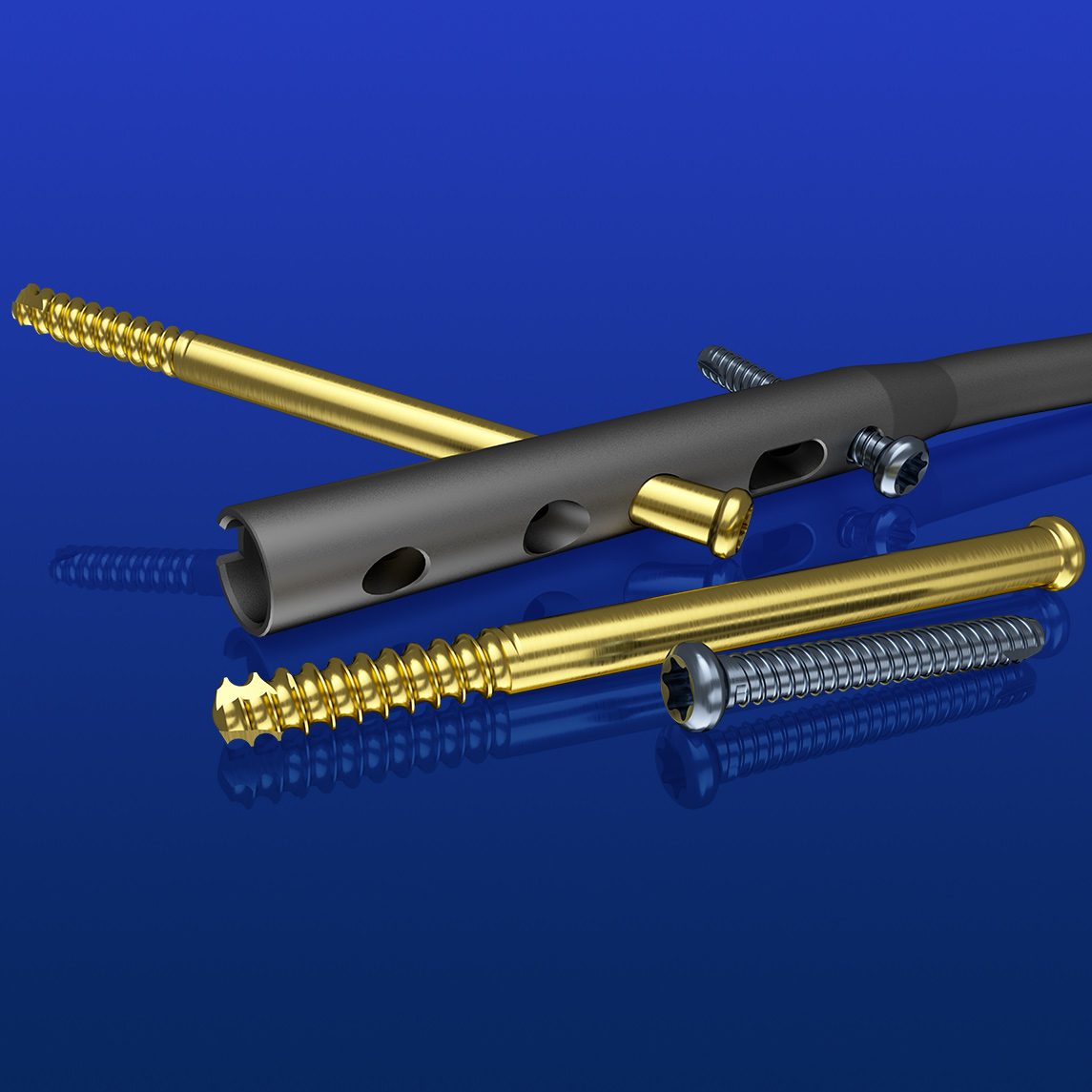 AUTOBAHN™ EVO Antegrade Femoral Nailing System | Globus Medical