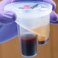 Harvest™ SmartPrep™ 3 System | Globus Medical