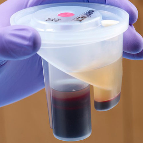 Harvest™ SmartPrep™ 3 System | Globus Medical