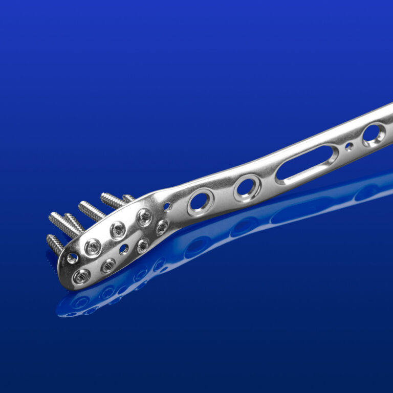 ANTHEM™ Ankle Fracture System | Globus Medical