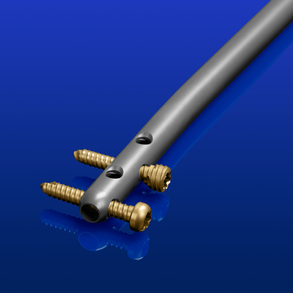 AUTOBAHN™ Tibial Nailing System | Globus Medical