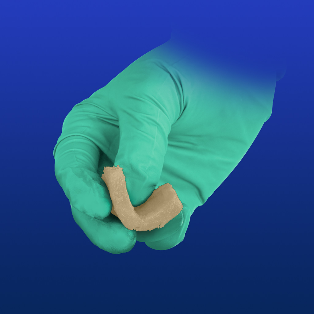 Ossifuse™ HSA Fiber Bone Graft | Globus Medical