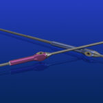 MARVEL™ Growing Rod System | Globus Medical